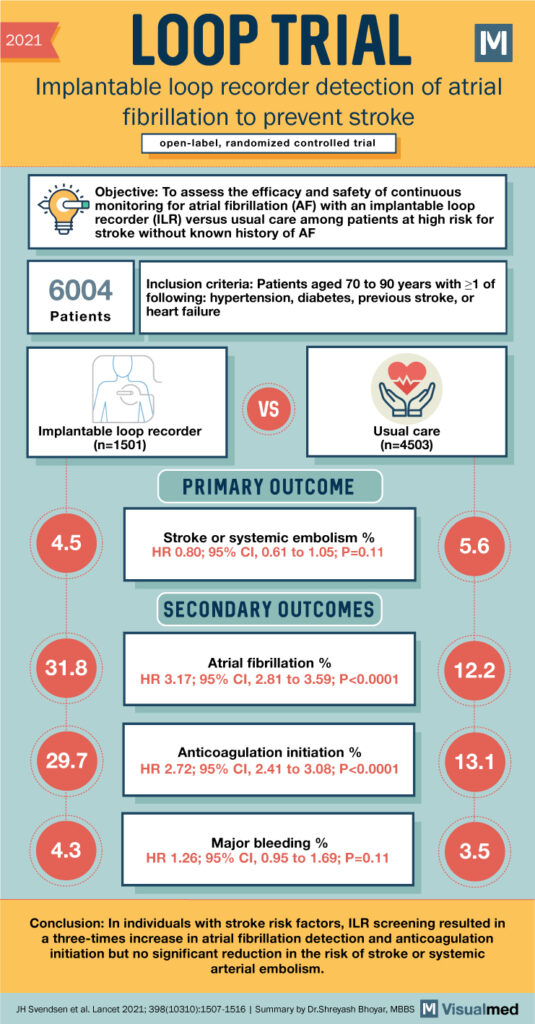 LOOP Trial: ILR for AFib to Prevent Stroke – Visualmed: Clinical Trials