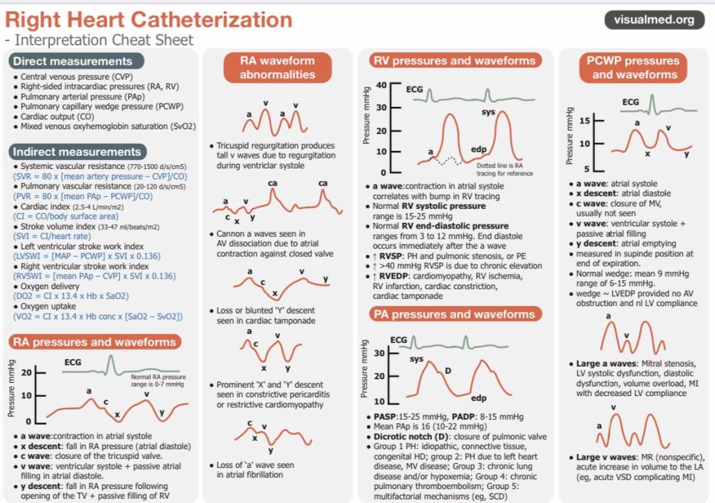 Right Heart Catheterization: A Quick Interpretation Guide - Visualmed ...